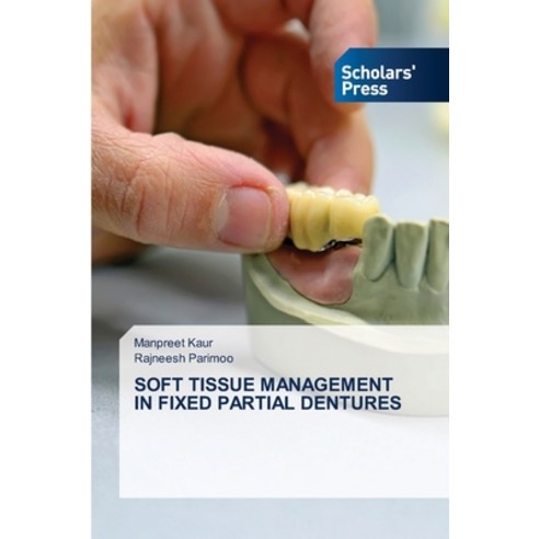 Soft Tissue Management in Fixed Partial Dentures Paperback, Scholars ...