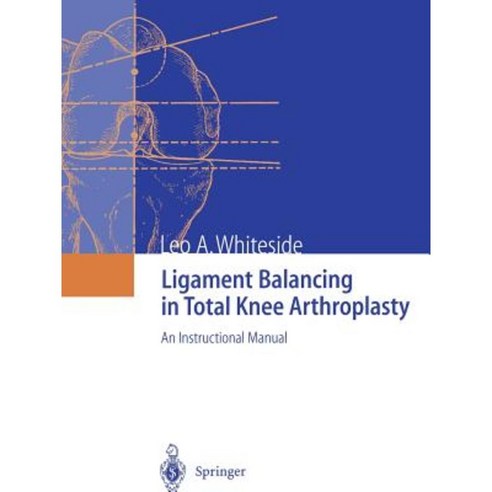 Ligament Balancing in Total Knee Arthroplasty: An Instructional Manual ...